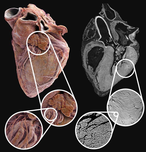 A unique atlas of the human heart: from cells to the full organ ...